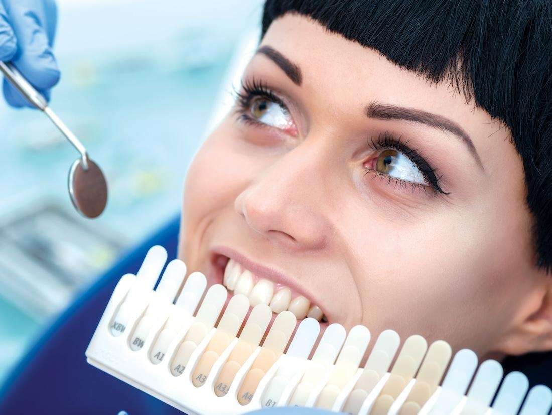 Dental Bonding: Quick Fix for a Flawless Smile | Cosmetic